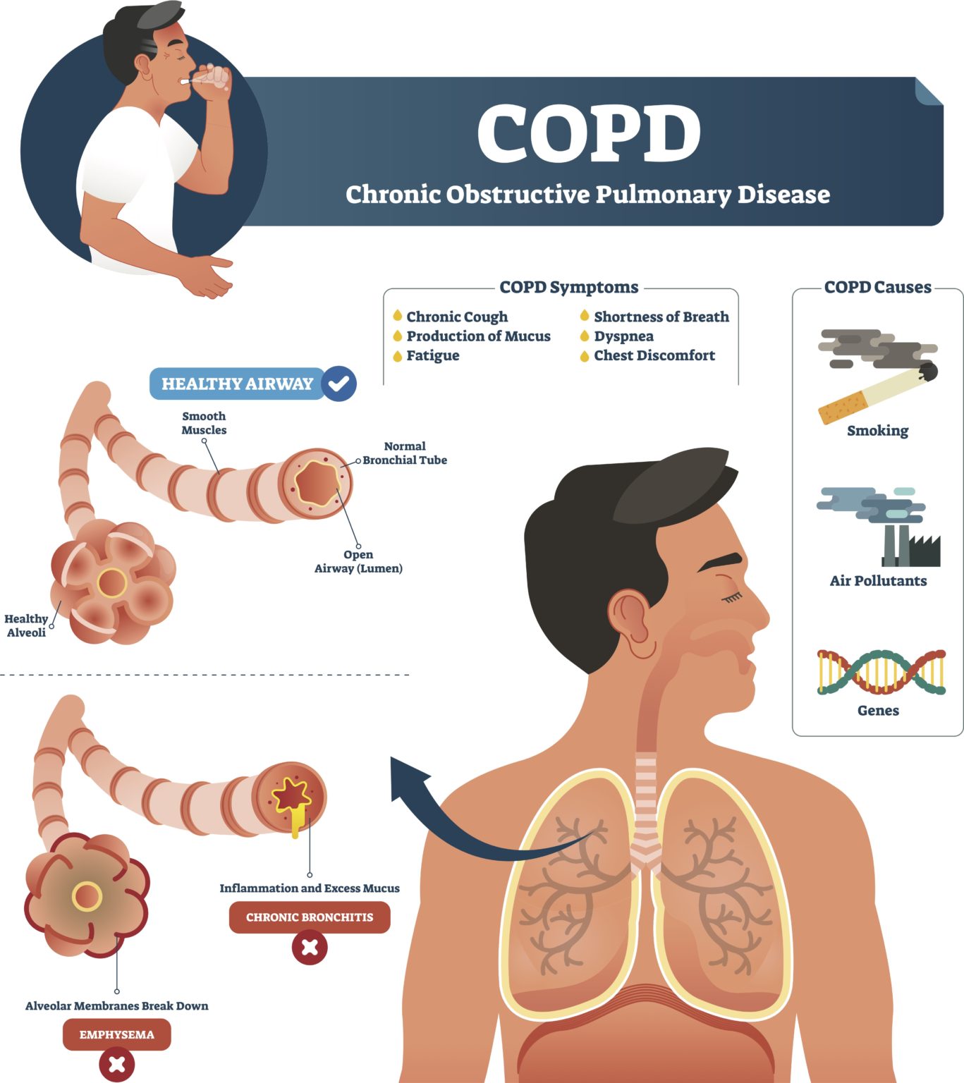 copd-and-covid-19-what-to-know-safercare-texas
